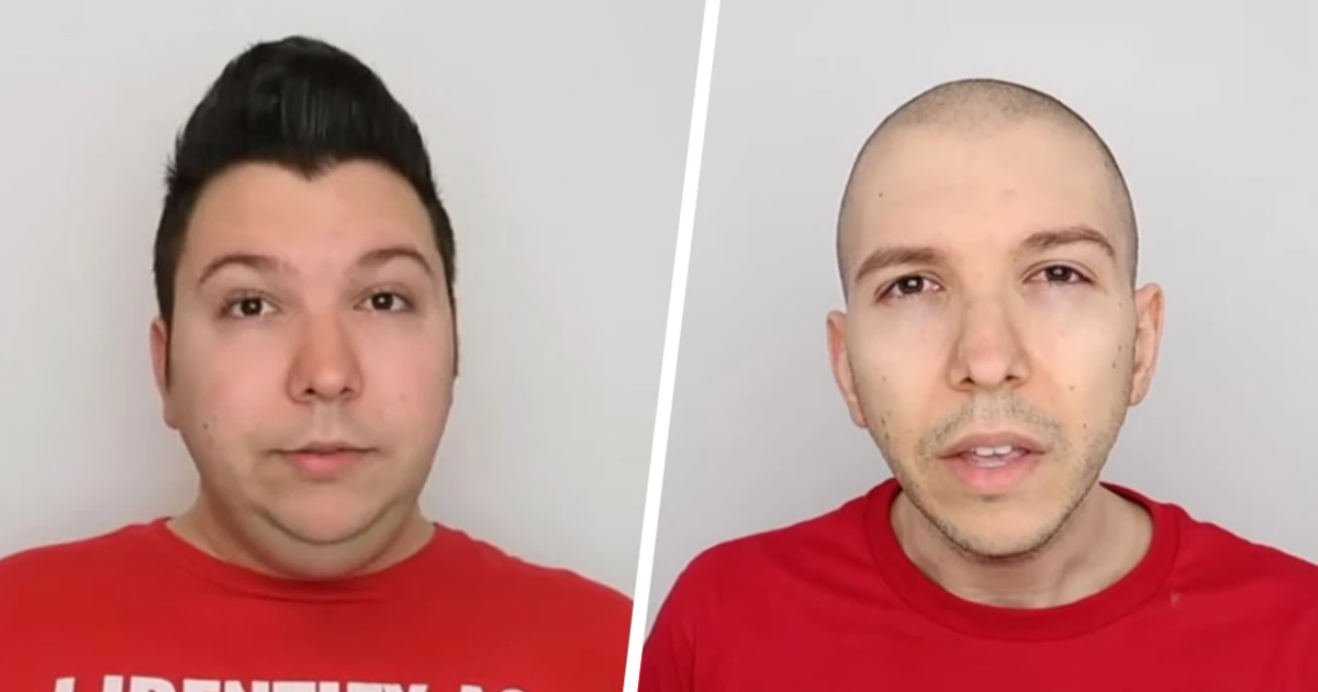 Nikocado Avocado’s Transformation